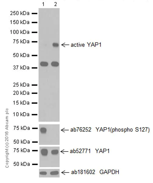 Anti-active YAP1 antibody [EPR19812] - recombinant (ab205270) | Abcam
