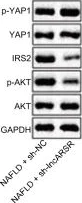 Anti-active YAP1 antibody [EPR19812] - recombinant (ab205270) | Abcam