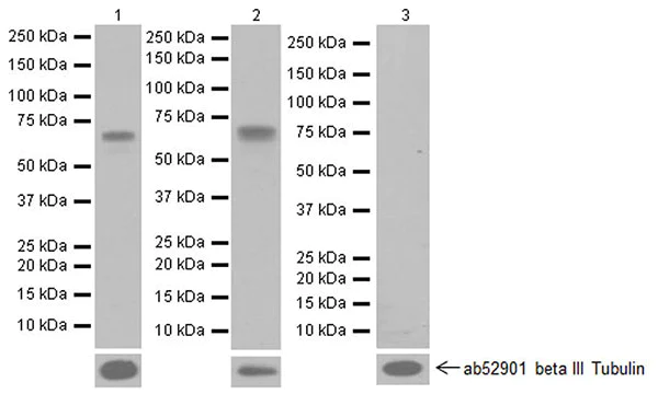 Anti-active YAP1 antibody [EPR19812] - recombinant (ab205270) | Abcam