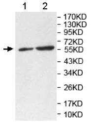 Anti-Activin Receptor Type IIB/ACVR2B antibody (ab128544) | Abcam