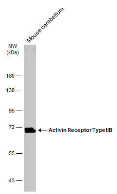Anti-Activin Receptor Type IIB/ACVR2B antibody (ab272869) | Abcam