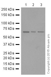 Anti-Activin Receptor Type IIB/ACVR2B antibody [EPR10739] (ab180185 ...