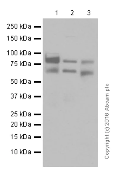 Anti-ADAM10 antibody [EPR5622] (ab124695) | Abcam