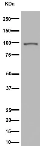 Anti-ADAM2 antibody [EP15281] (ab193668) | Abcam