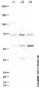 ADAMTS5抗体 (ab41037)| Abcam中文官网
