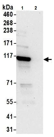 Anti-ADAR1 antibody (ab226188) | Abcam
