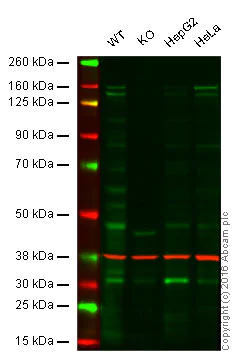 Anti-ADAR1 antibody [EPR7033] (ab126745) | Abcam