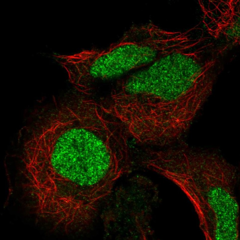 Anti-ADAT3 antibody (ab247133) | Abcam