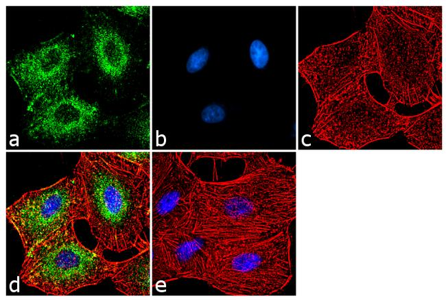 Anti-Adenosine A1 Receptor antibody (ab3460) | Abcam