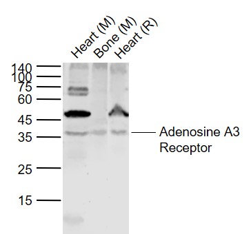 Anti-Adenosine A3 Receptor/A3AR antibody (ab203298) | Abcam
