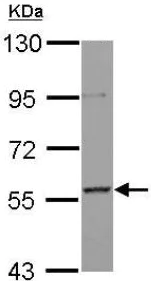 Anti-AF9 antibody (ab154492) | Abcam