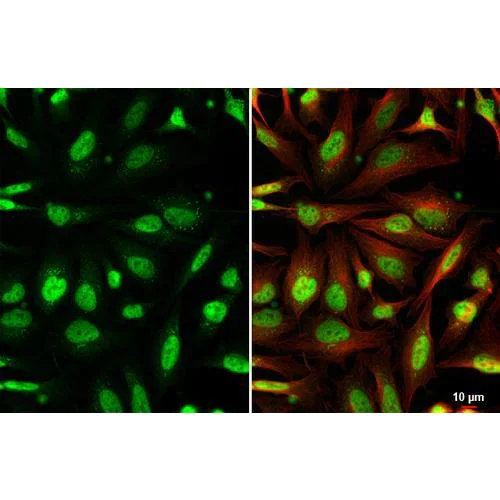 Anti-AF9 antibody [HL1644] (ab317100) | Abcam中文官网
