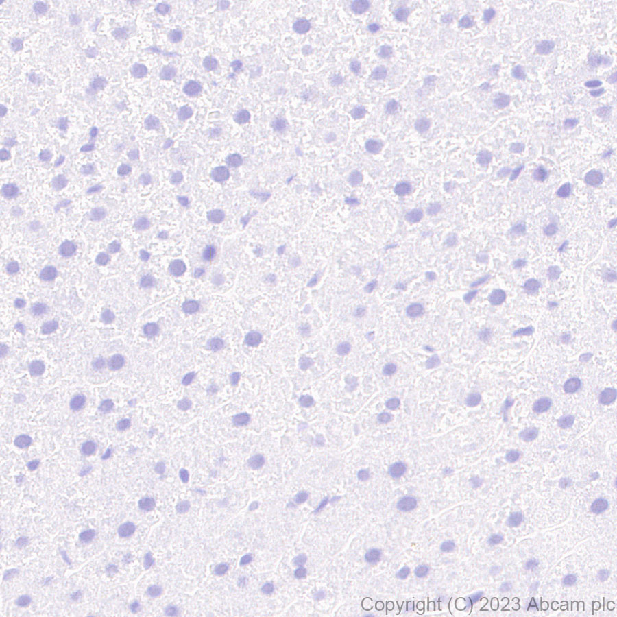 Anti-Aggrecan antibody [RM2036] (ab315486) | Abcam