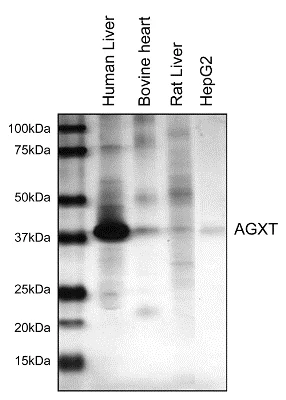 Anti-AGXT antibody [1F9BC7] (ab110313) | Abcam