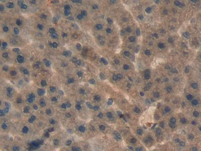 Anti-Ahsp antibody (ab231040) | Abcam