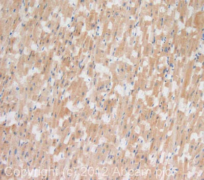 Anti-AIF antibody [7F7AB10] - Mitochondrial Marker (ab110327) | Abcam