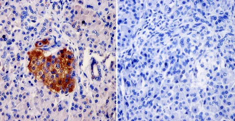 Anti-AKAP9 antibody [17G10] (ab32679) | Abcam
