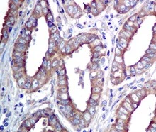 Anti-AlaRS antibody [EPR11037(B)] (ab155275) | Abcam