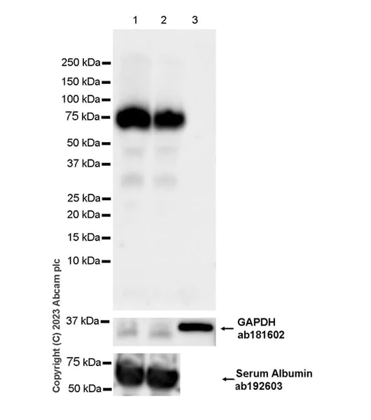 Albumin抗体[EPR12774] (ab192603)| Abcam中文官网