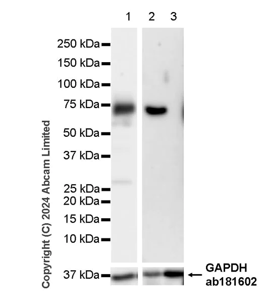 Anti-Albumin antibody [EPR23014-11] - BSA and Azide free (ab277249) | Abcam