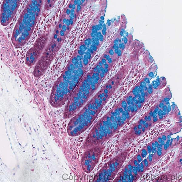 Alcian Blue Stain试剂盒(pH 2.5, Mucin Stain) (ab150662)| Abcam中文官网