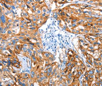 Anti-Aldehyde Oxidase antibody - C-terminal (ab197828) | Abcam