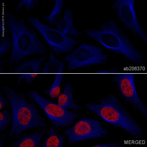 Anti-beta Tubulin Alexa Fluor® 405 antibody [EPR16774] (ab206370) | Abcam