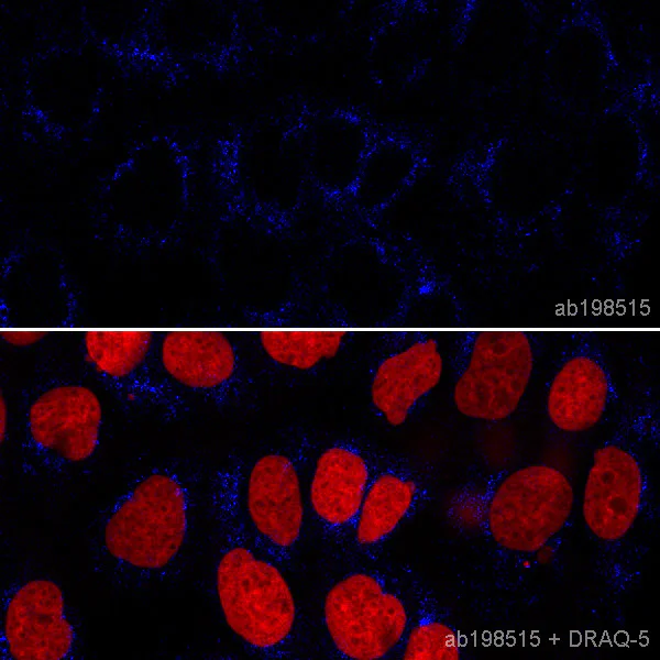 Alexa Fluor® 405 Anti-M6PR (cation independent)抗体[EPR6599] - Lysosome ...