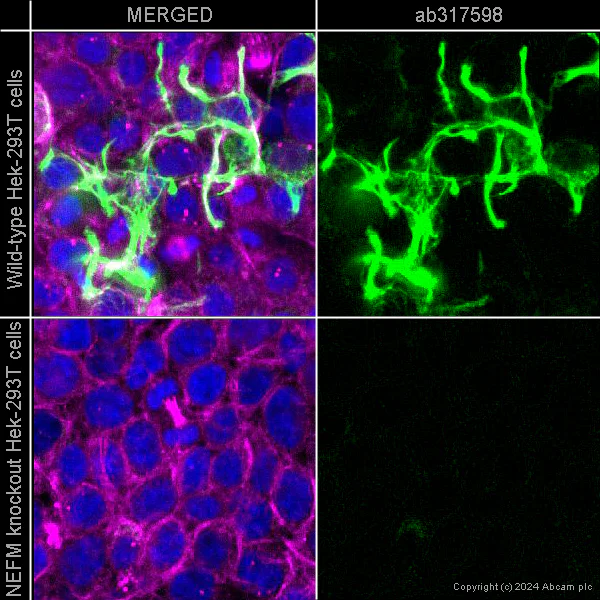 Alexa Fluor® 488 Anti-160 kD Neurofilament Medium antibody [EPR23510-76 ...