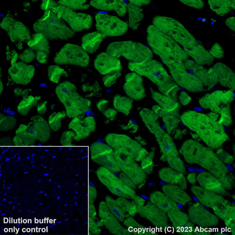 Alexa Fluor® 488 Anti-Alpha B Crystallin antibody [EPR2752] (ab315853 ...