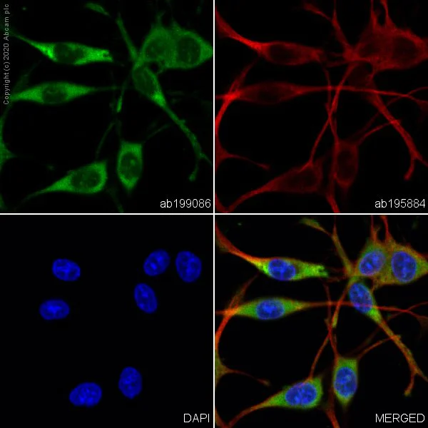 Alexa Fluor® 488 Anti-alpha + beta Synuclein antibody [EP1646Y] (ab199086)
