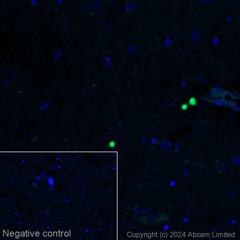 Alexa Fluor® 488 Anti-Alpha-synuclein (phospho S129) antibody [EP1536Y ...