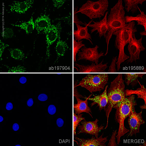 Alexa Fluor® 488 Anti-ATPB antibody [3D5] (ab197904) | Abcam