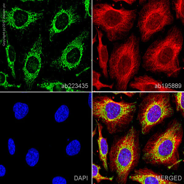 Alexa Fluor® 488 Anti-ATPB antibody [EPR11990] (ab223435) | Abcam