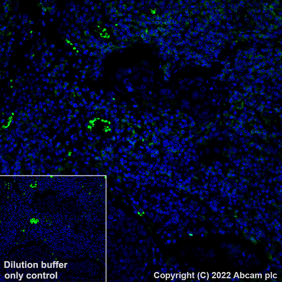 Alexa Fluor® 488 Anti-CD11a antibody [EP1285Y] (ab307764) | Abcam