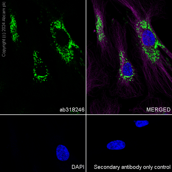 Anti-CD63 Alexa Fluor® 488 antibody [KILL150A] (ab318246) IgG | Abcam