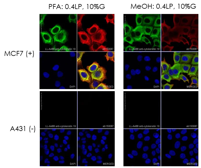 Alexa Fluor® 488 Conjugation kit | Easy Alexa Fluor® 488 Labelling ...