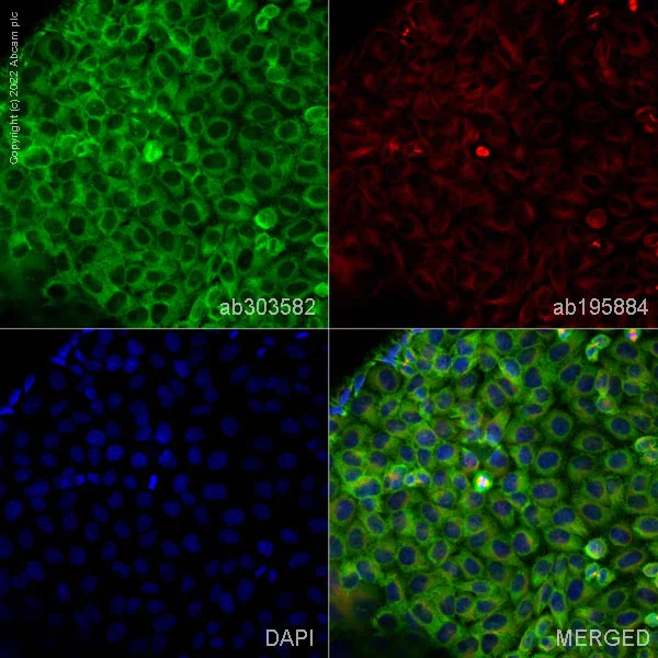 Alexa Fluor® 488 Anti-ENO1 antibody [EPR19758] (ab303582) | Abcam