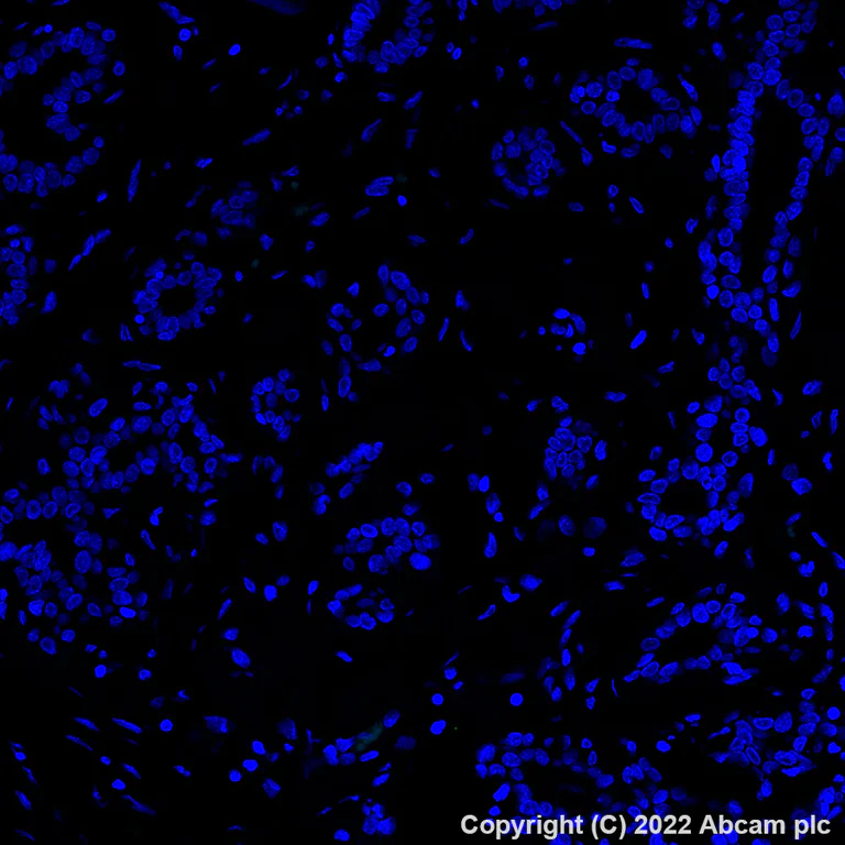 Alexa Fluor® 488 Anti-ErbB2 / HER2 + ErB4 / HER4 antibody [EPR22665-104] (ab305221) | Abcam