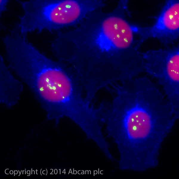 Fibrillarin抗体- Nucleolar Marker (ab5821)| Abcam中文官网