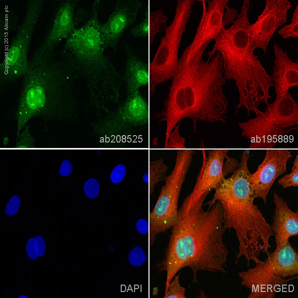 Alexa Fluor® 488 Anti-FOXO4/AFX antibody [EPR5442] (ab208525) | Abcam