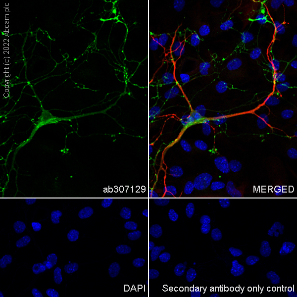 Alexa Fluor® 488 Anti-GAD65 antibody [EPR22952-70] (ab307129) | Abcam