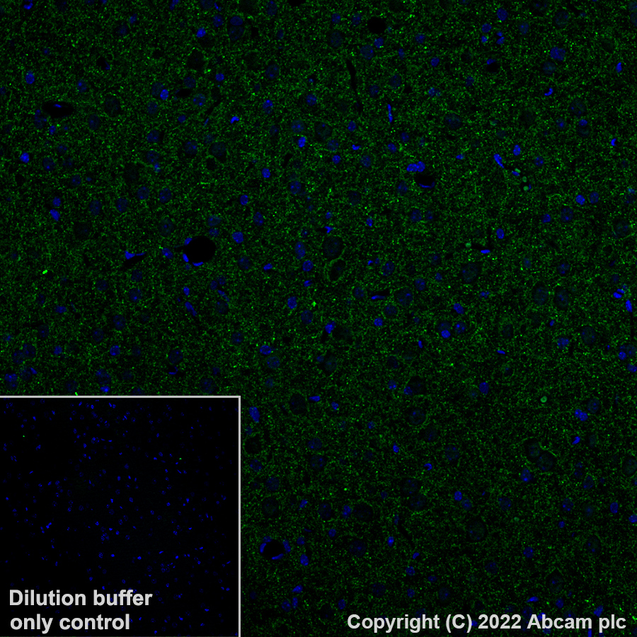 Alexa Fluor® 488 Anti-GAD65 antibody [EPR22952-70] (ab307129) | Abcam