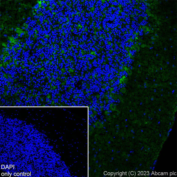 Alexa Fluor® 488 Anti-GAD65 + GAD67 antibody [EPR19366] (ab314811) | Abcam
