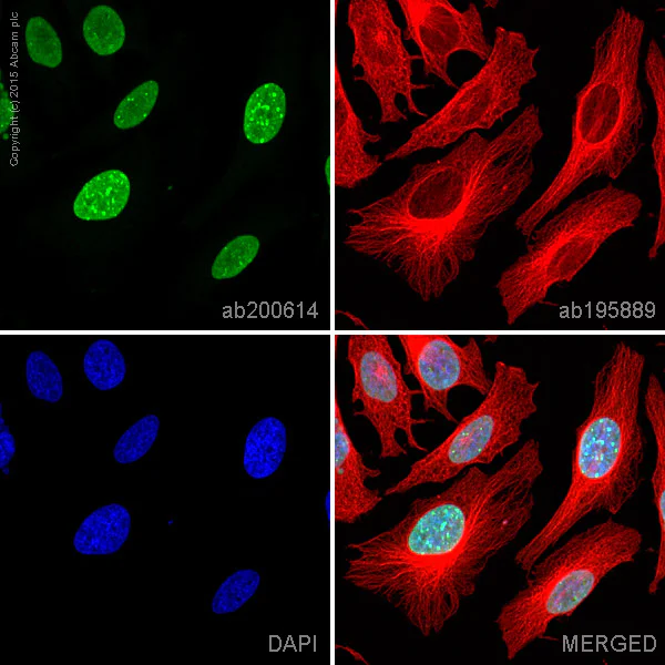 Alexa Fluor® 488 Anti-Histone H3(磷酸化S10 + T11)抗体[E173] (ab200614 ...