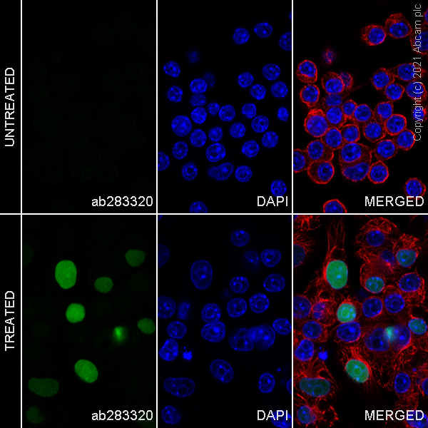 Anti-Chaperone protein HtpG 抗体 (ab225994) | Abcam