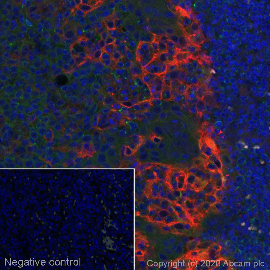 Integrin alpha V抗体[EPR16800] (ab179475)| Abcam中文官网