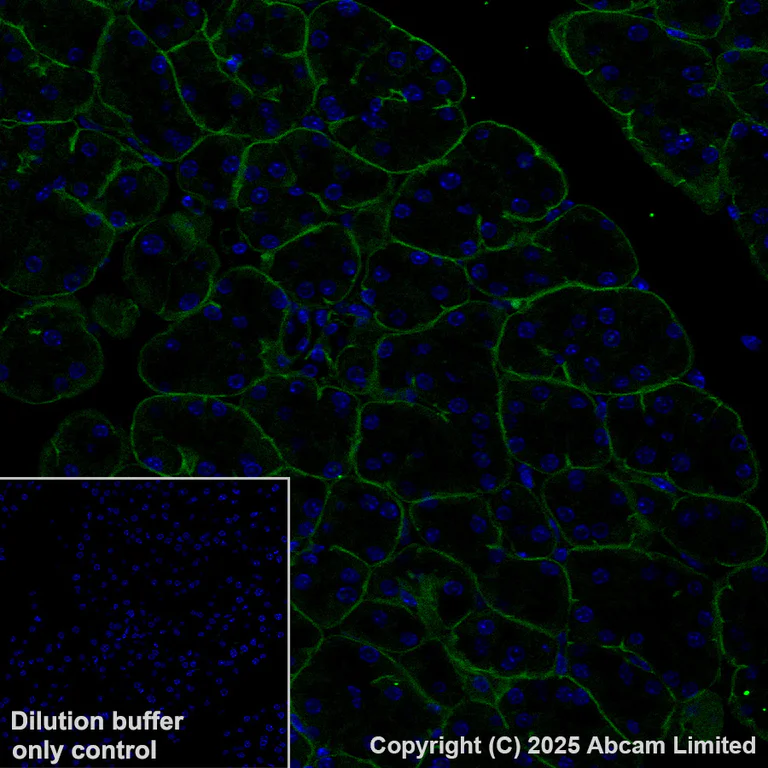 Alexa Fluor® 488 Anti-Integrin beta 4 antibody [EPR17517] (ab323999) | Abcam