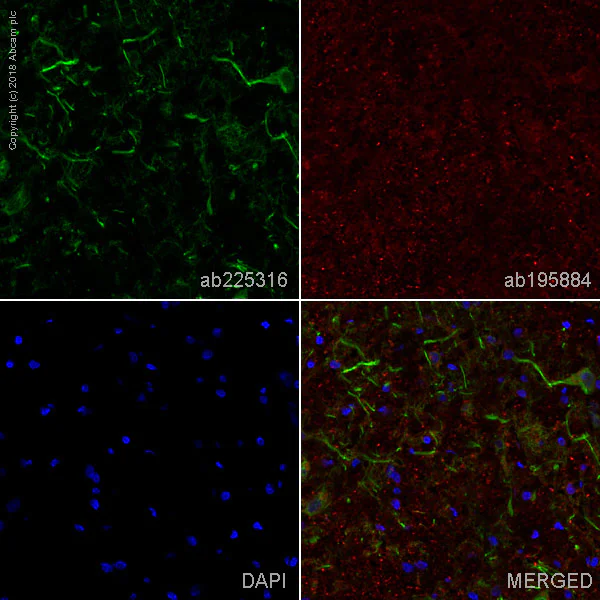 Anti-MAP2 Alexa Fluor® 488 antibody [EPR19691] (ab225316) IgG | Abcam