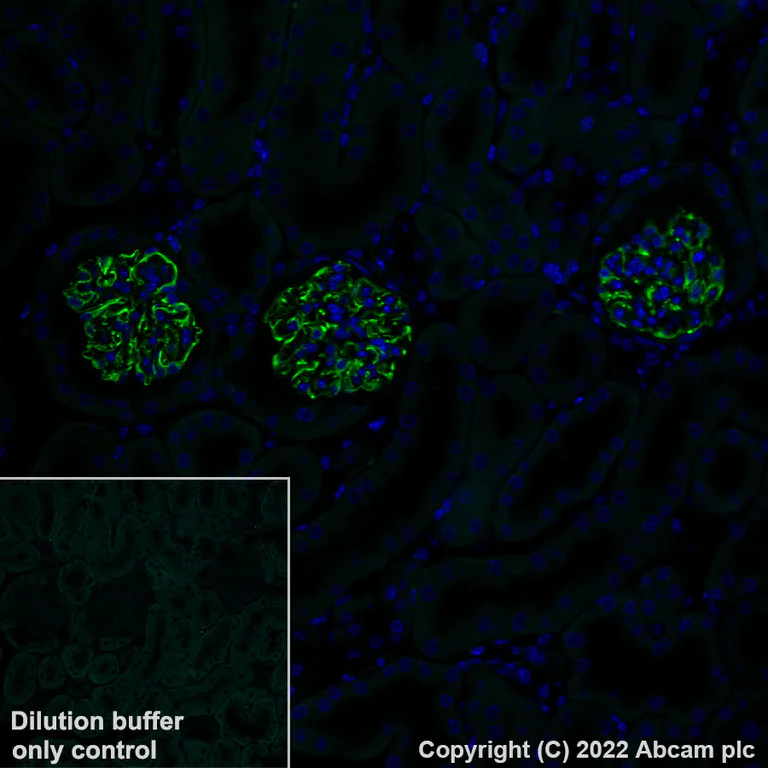 Alexa Fluor® 488 Anti-Nestin antibody [EPR22023] - Neural Stem Cell ...